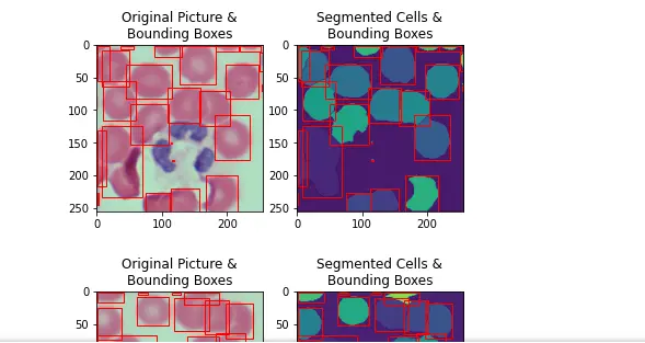 Ml Guide On Cell Segmentation Using Watershed Algorithm 3040